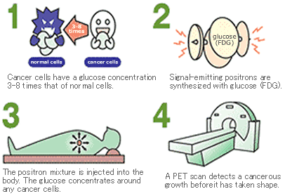 PET Medical Examination | Health activities | Bosch Health Insurance Society